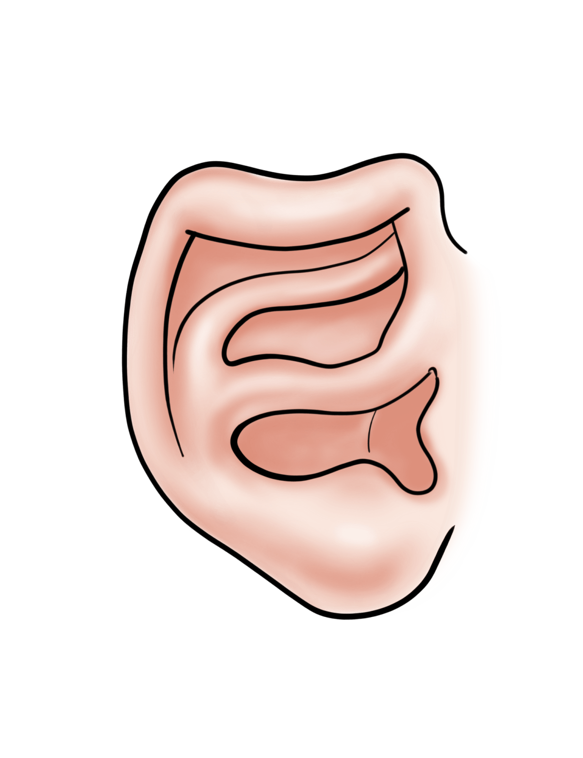 Understanding Ear Deformities - EarGear