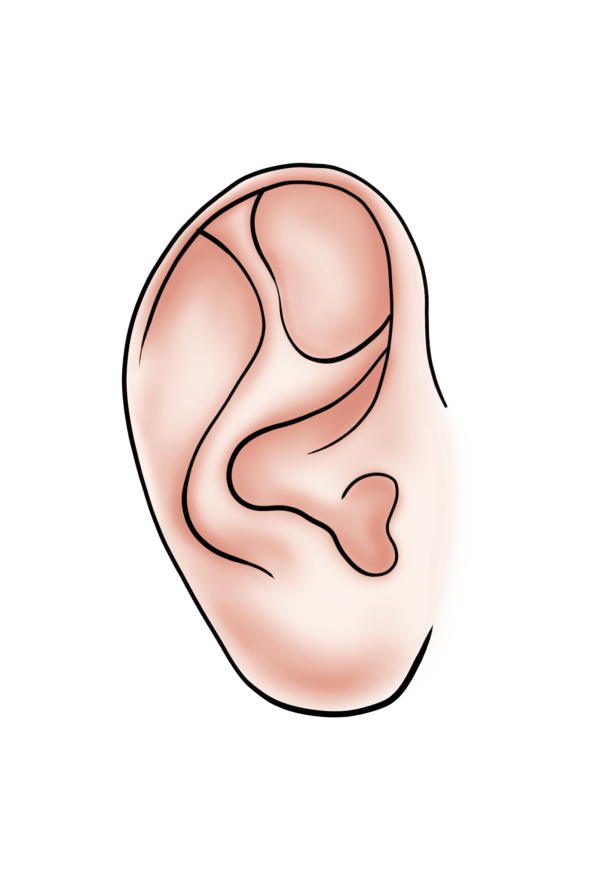Ear Deformities - 1 in 3 infants are born with an ear deformity